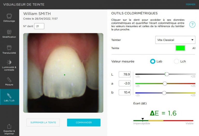 Digital Shade Analyzer, Rayplicker Cobra - Denterprise International Inc